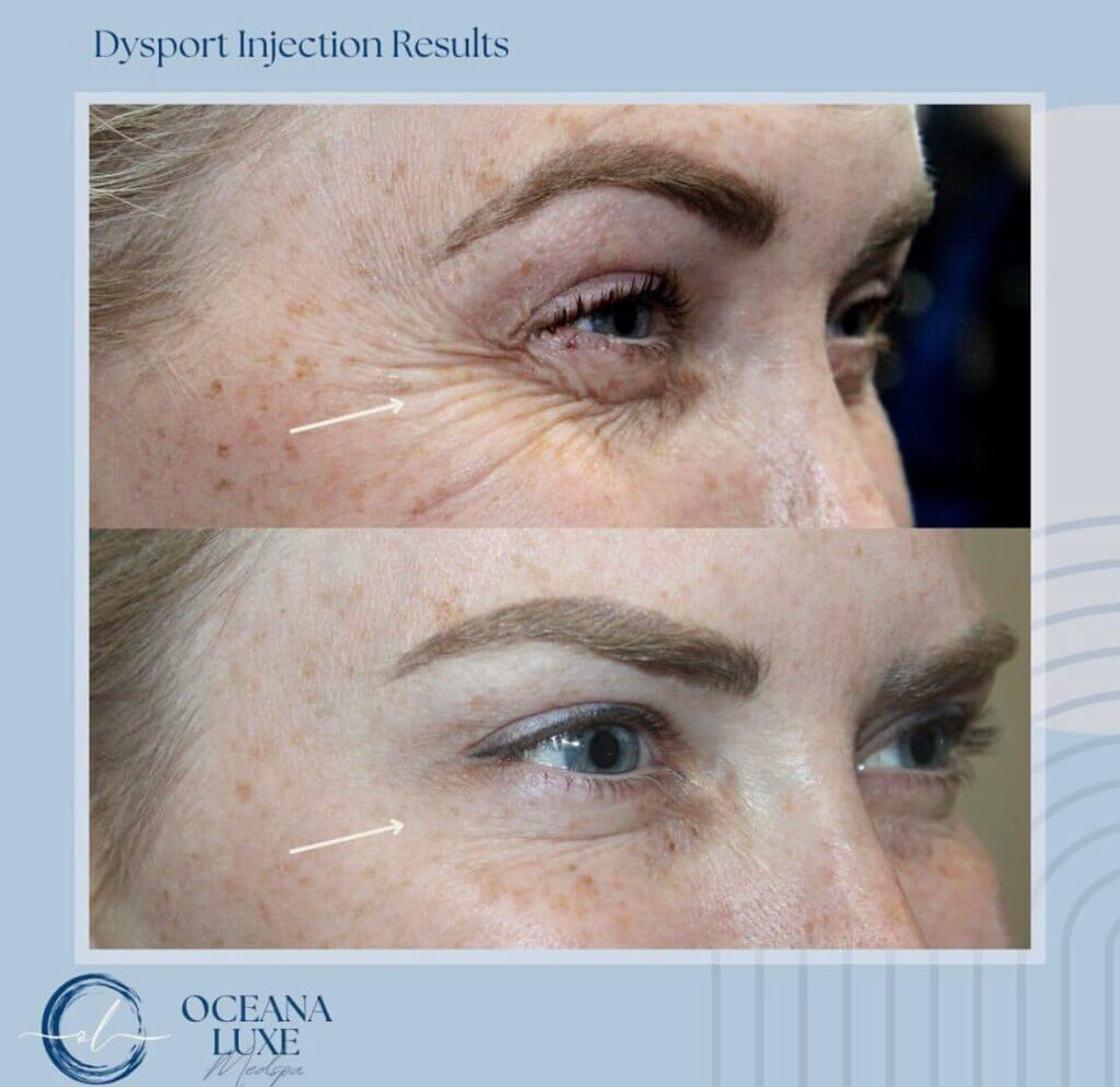 Medspa Before and After Images at Oceana Luxe Medspa